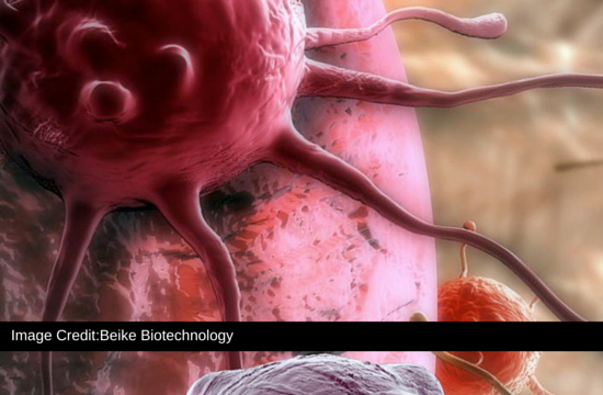 New Techniques Involve Engineered T Cells For Treatment Of Cancer ...