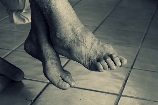 Trinity crew uncovers mutations connected with early onset dementia ...