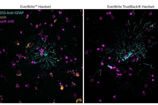 Biotium Launches First Ever Mounting Media with Far-Red Nuclear ...
