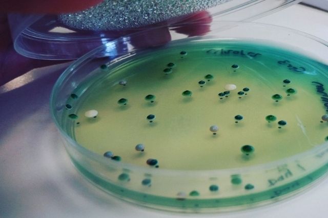 Reducing Microbial Contamination Risk in Pharmaceutical Manufacturing ...