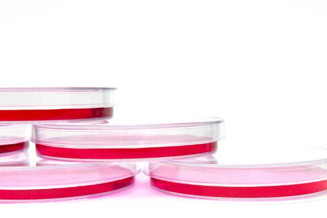 Understanding the Significance of Violet Red Bile Lactose Agar (vrbl ...